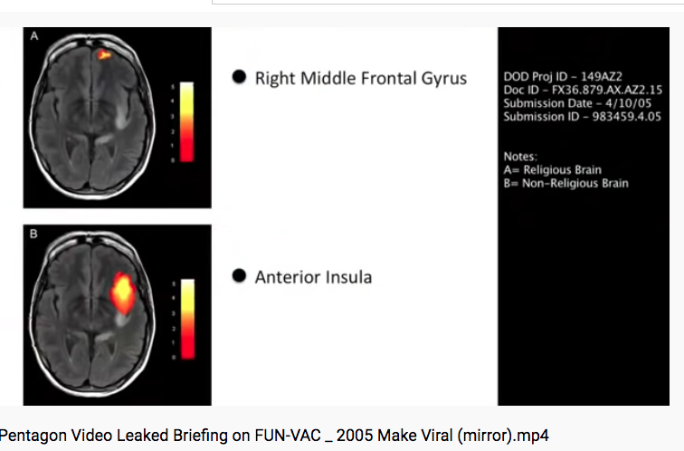 Vmat2, God and You! – WideAsTexas.com